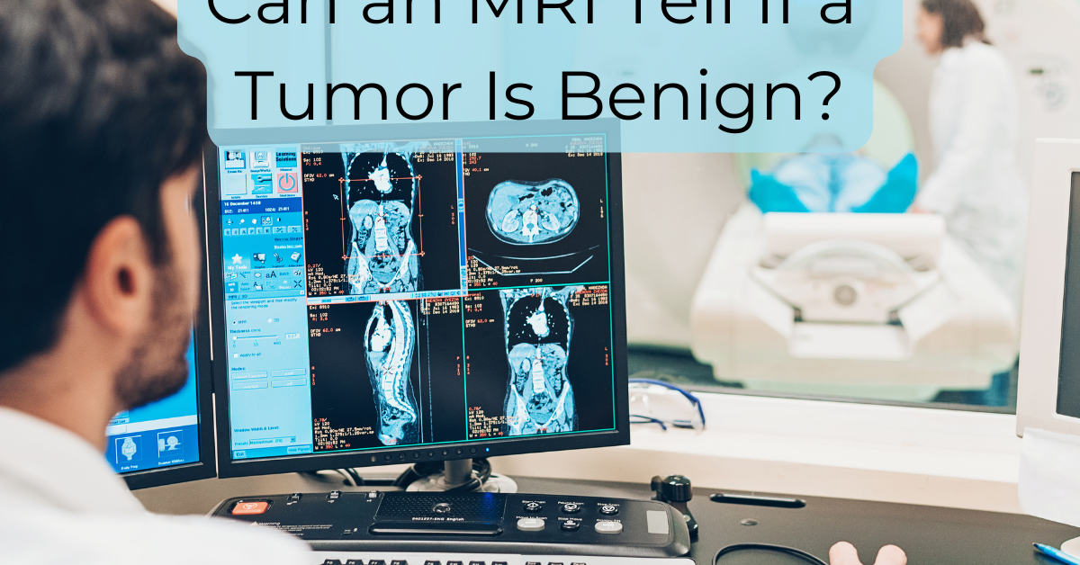Can an MRI Tell If a Tumor Is Benign? | Tisch Brain Tumor Center